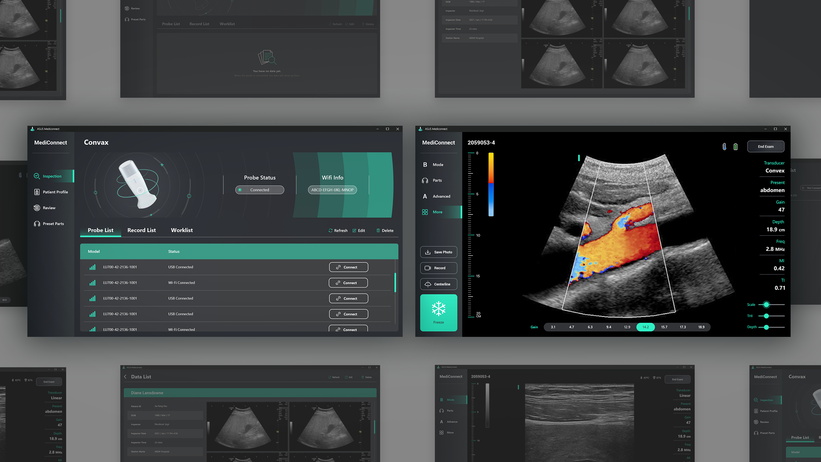 iF Design - ASUS portable ultrasound solution