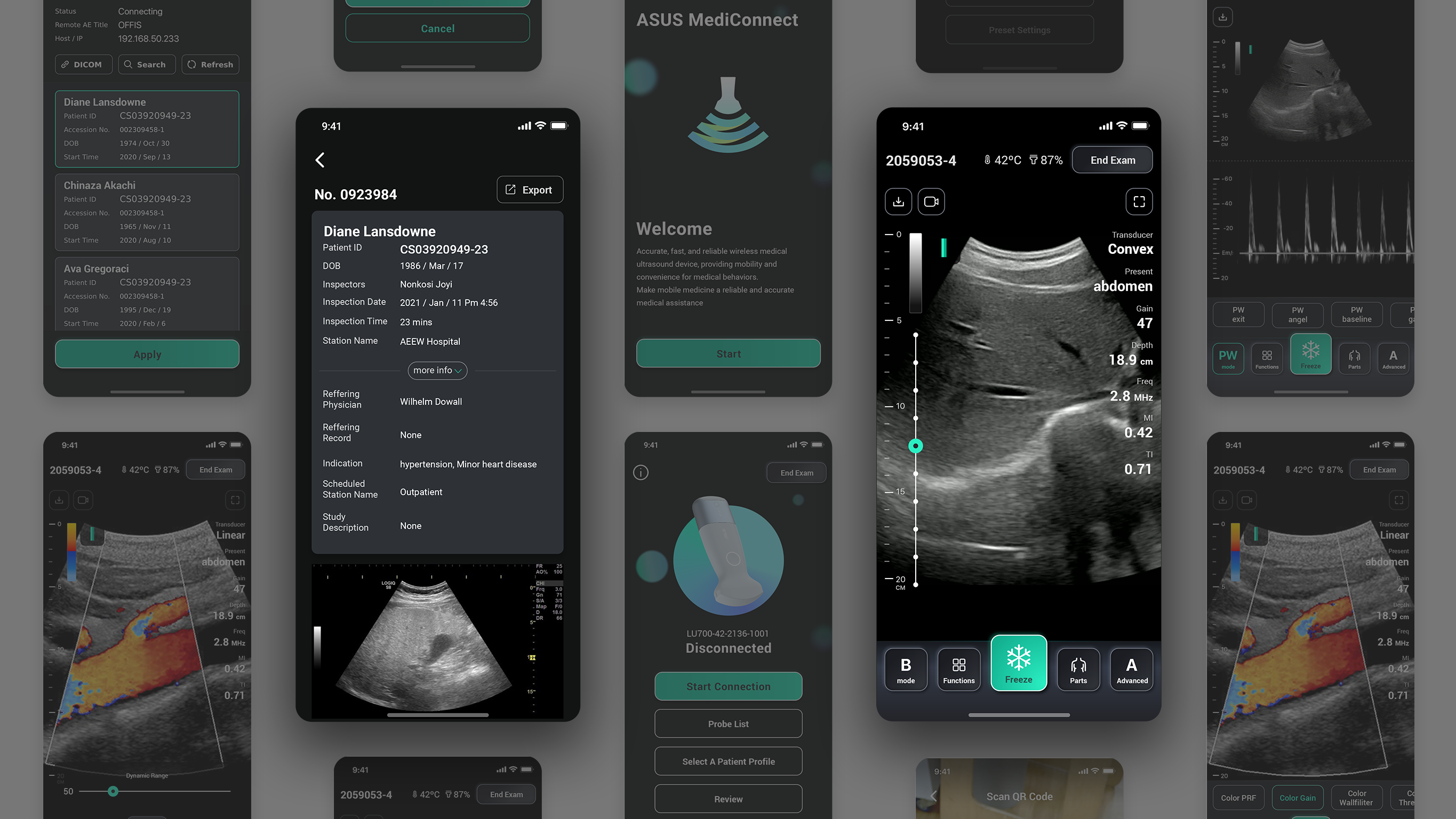 iF Design - ASUS portable ultrasound solution