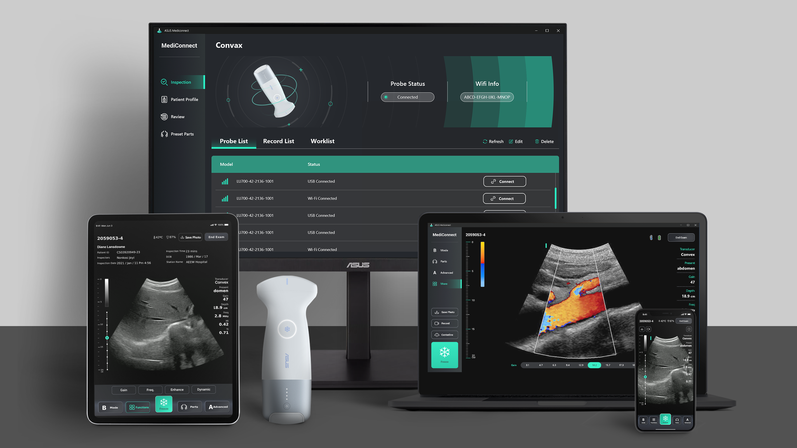 iF Design - ASUS portable ultrasound solution