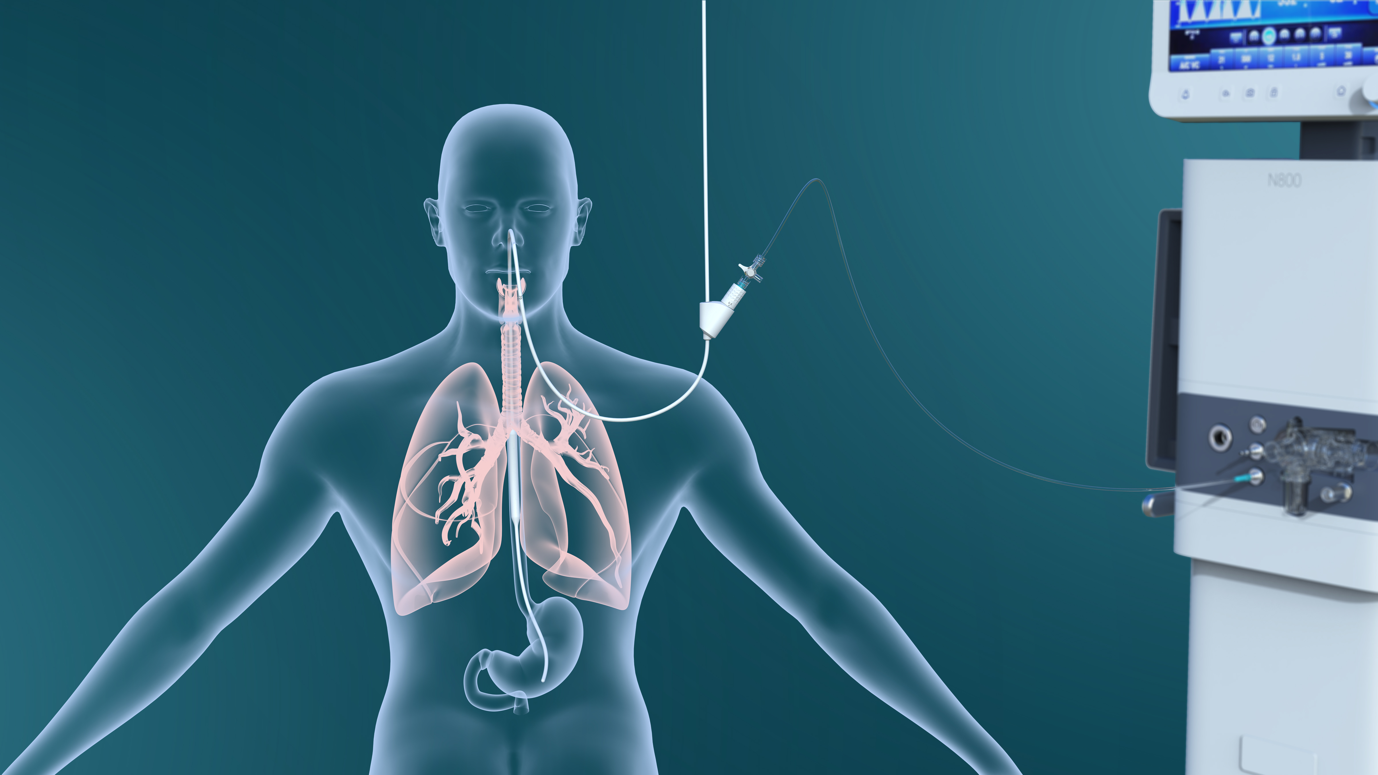 iF Design - Multifunctional medical detection catheter