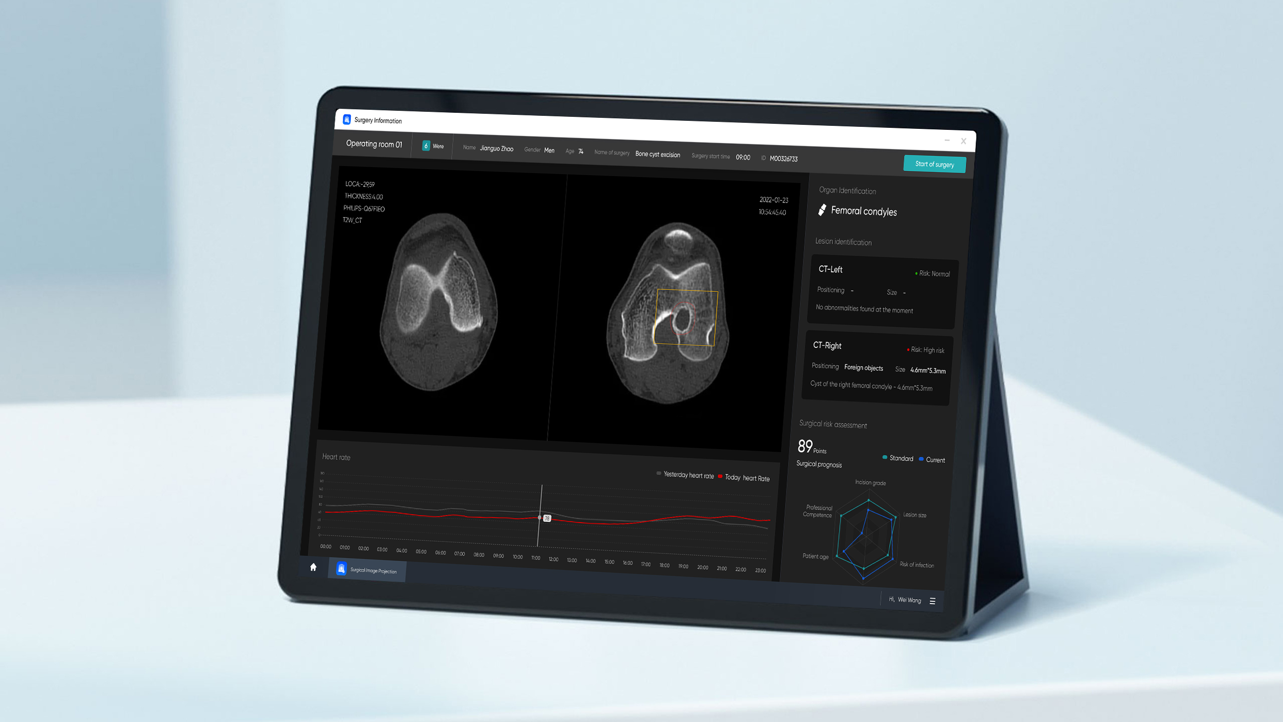 iF Design - Intelligent operating room
