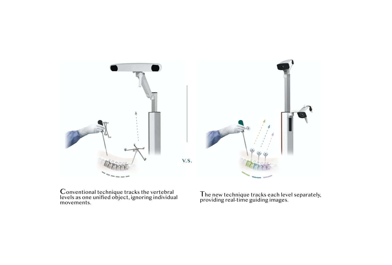 iF Design - Continuous Tracking Surgical Assistance System
