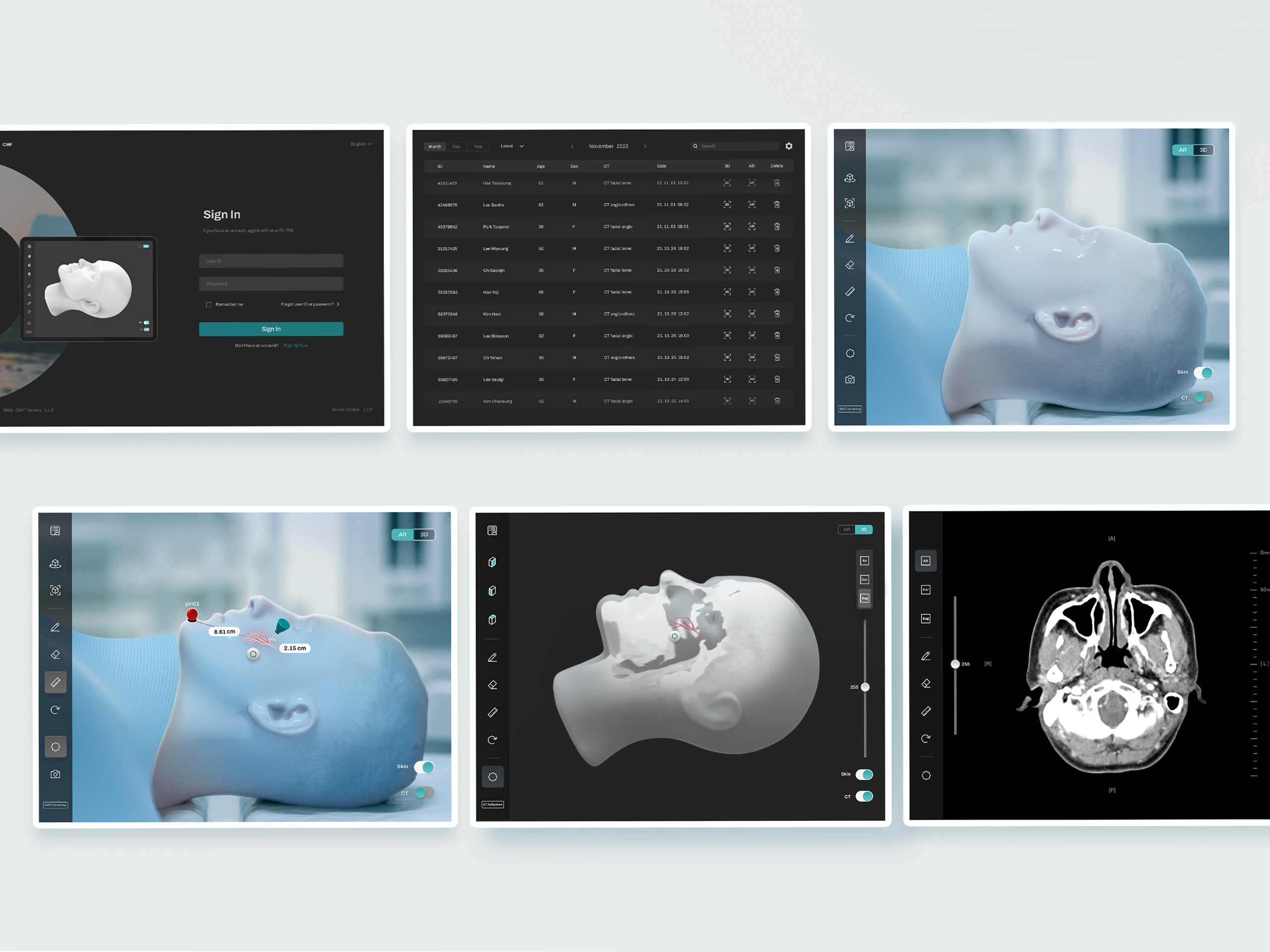 iF Design - SKIA CMF